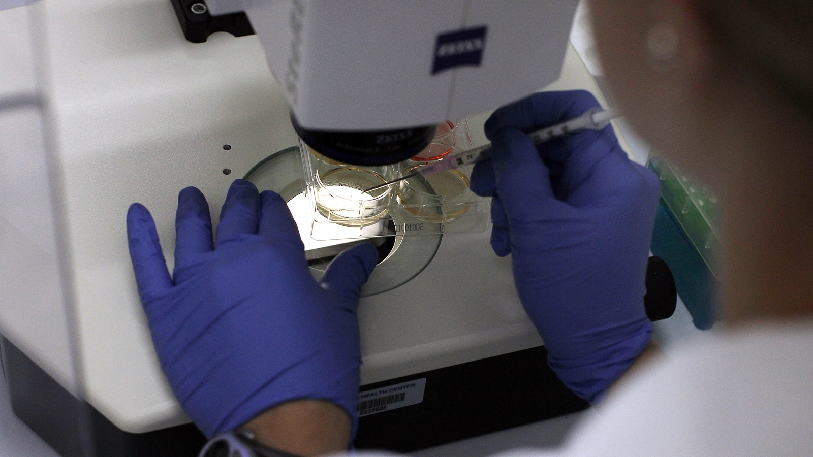 Less burden on families if stem cell transplants here