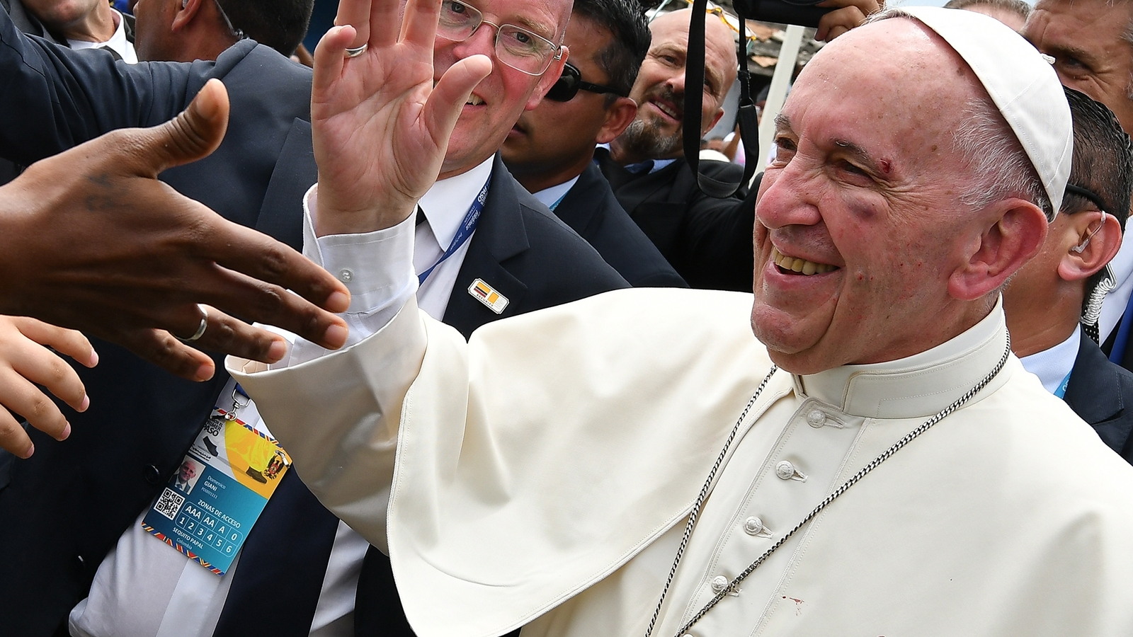 Pope suffers black eye after falling in popemobile